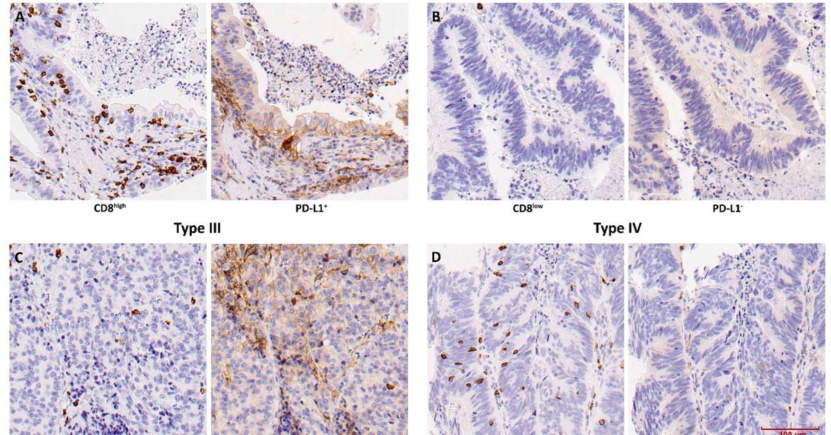 Desarrollan un anticuerpo que podría abrir un nuevo tratamiento para ...